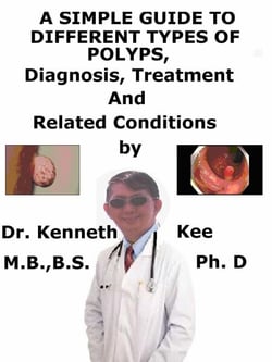 A Simple Guide to Different Types of Polyps, Diagnosis, Treatment and ...